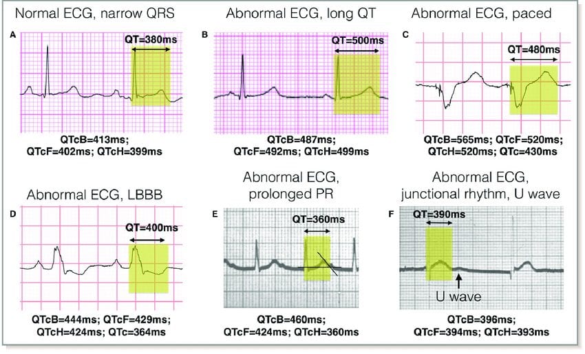 The World of ECGs | Stenberg College