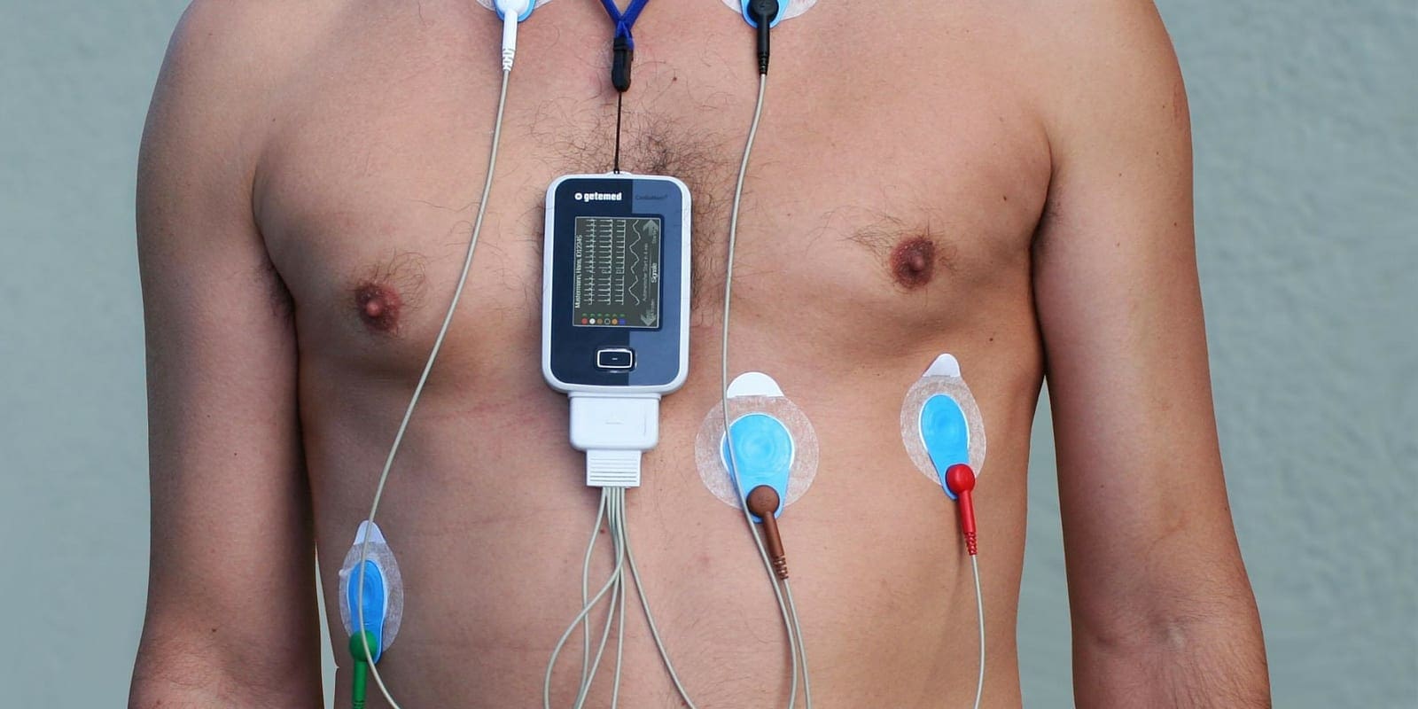 Cardiology Holter Monitoring | Stenberg College